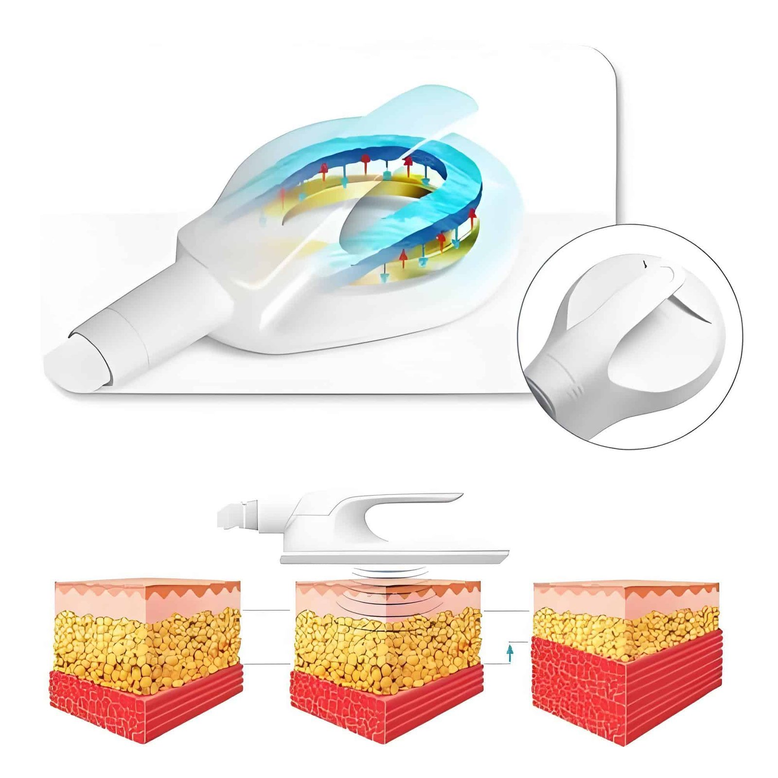 Emsculpt Neo Machine - Delya: Expert Beauty Equipment Manufacturer