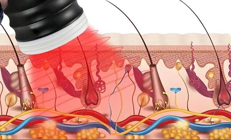 Comparing 30K, 40K, 80K Cavitation Machines Types